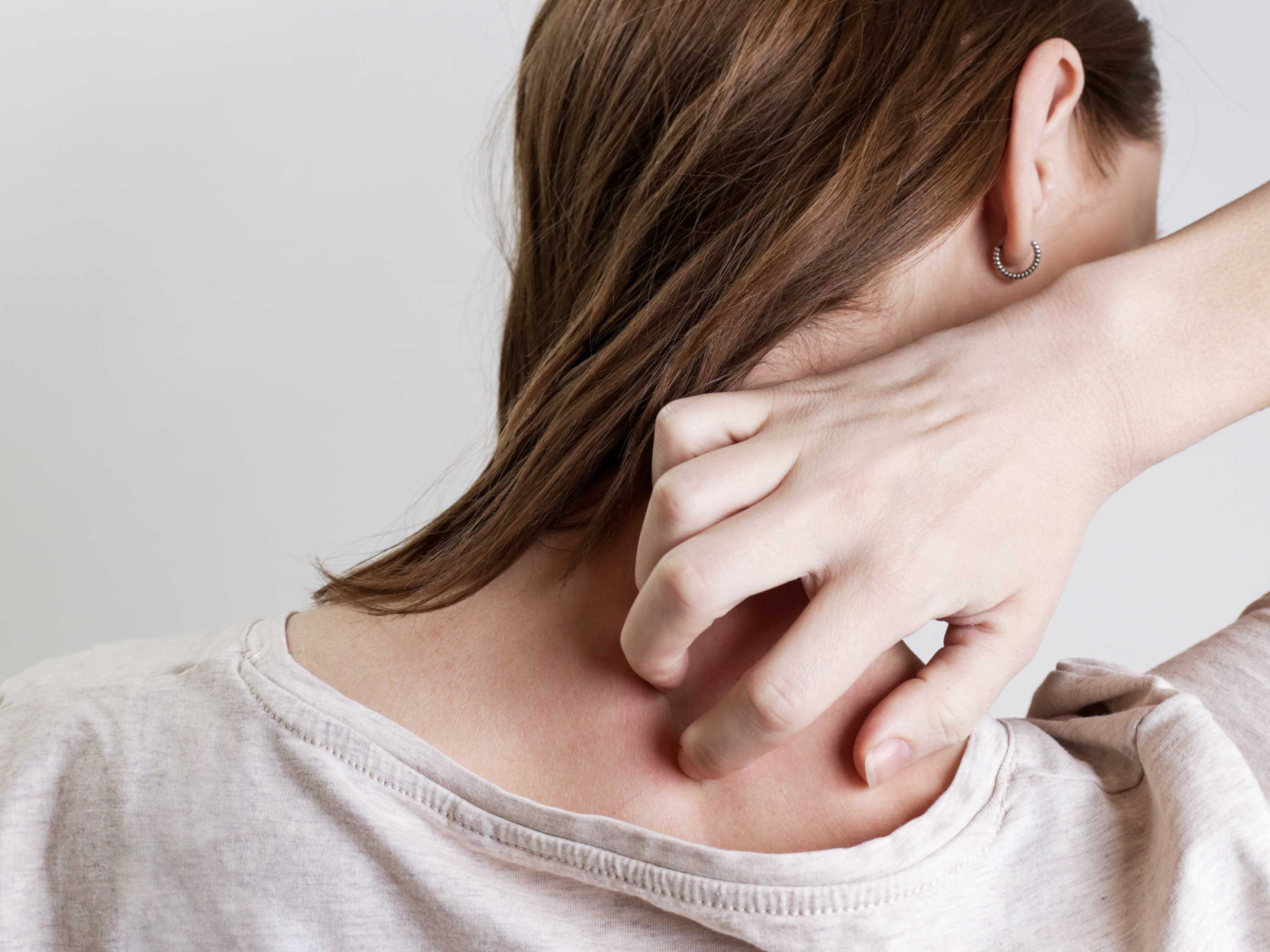 The Difference Between Eczema, Psoriasis & Dermatitis – esmi Skin